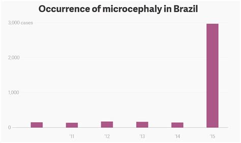 Almost 500 New Cases Of Zika Induced Microcephaly Reported In Brazil