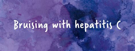 Bruises And Hepatitis C What To Know And Prevention