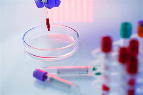 Lab Professionals Test For Bacteria In Human Body Photo Background And Picture For Free Download