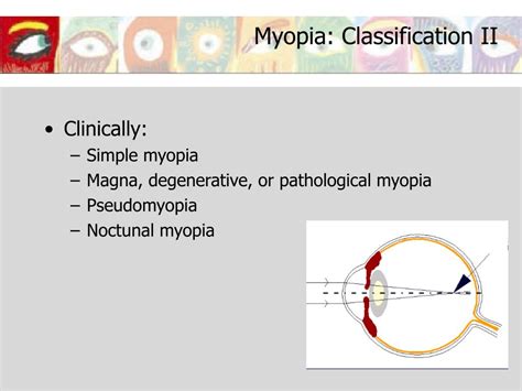 Ppt Myopia Powerpoint Presentation Free Download Id5459221