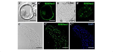 Immunofluorescence Of H3k9me2 During Microspore Embryogenesis
