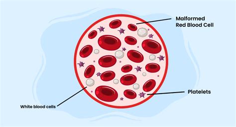 Alpha Thalassemia Exploring Genetics And Hemoglobin Insights Medtigo