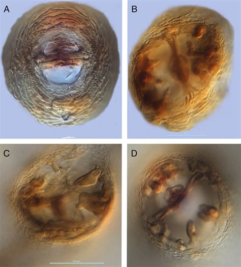 A D Light Micrograph Of Vulval Cones Of H Medicaginis Showing Download Scientific Diagram