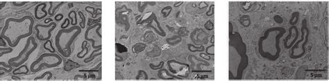 Ultra Microstructure Of The Ipsilateral L5 Spinal Nerve In Each Group