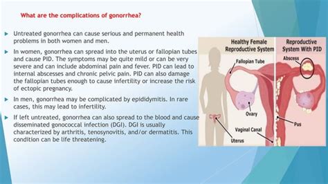 Sexually Transmitted Disease Gonorrhea Ppt