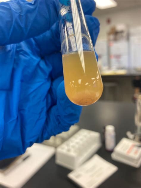 Need Help Identifying A Bacteria Rmicrobiology