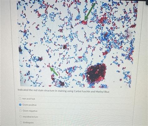 Solved Indicate The Gram Type And Fermentation Pattern On
