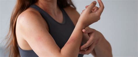 Cbd And Inflammation Exploring The Superpowers Of Cbd Oil Cbd2heal