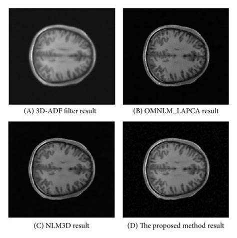The Denoised Images Residuals And Detail Denoised Images Of Different