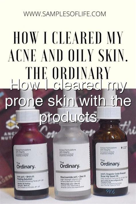 How I Cleared My Acne Prone Skin With The Ordinary Products