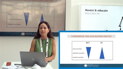 Optimizing OCT Usage In Glaucoma Management Sophia Porto Castro WGC 23