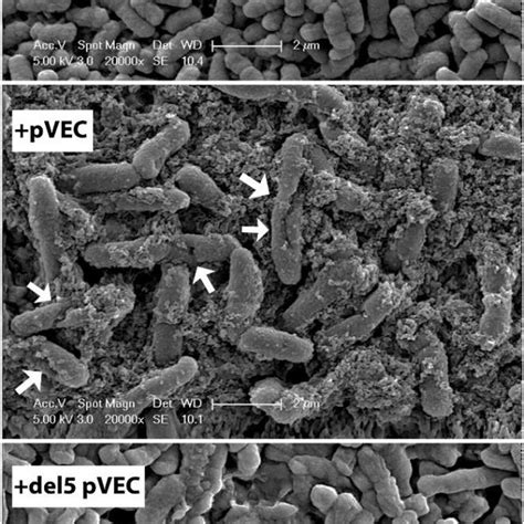 SEM Imaging Of Escherichia Coli Cells On Membrane Filters Untreated E