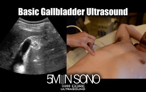 Gallbladder Ultrasound