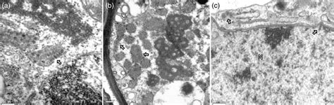 Transmission Electron Micrographs Of Ultrathin Sections Of Symptomatic Download Scientific