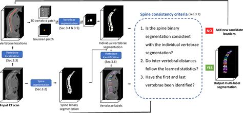 Figure 1 From Vertebrae Segmentation Identification And Localization