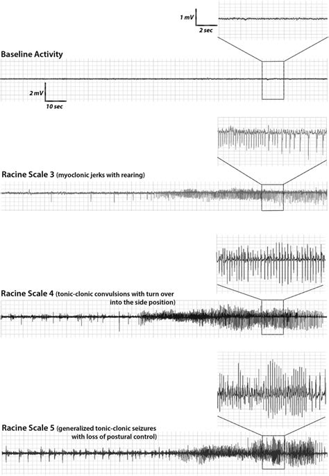 Traces Of Eeg During Ictal Activity In Spraguedawley Rats Following Download Scientific