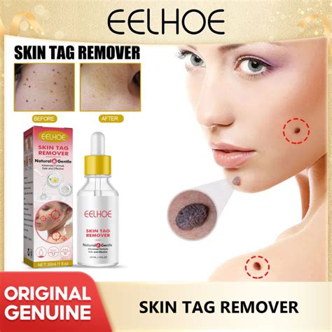 Eelhoe Skin Tag Recover Mole And Wart Essence Skin Face Armpit Meat
