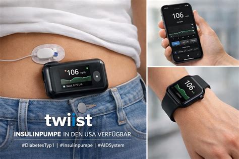 Zucker 🌀 Twiist Die Neue Insulinpumpe Die Deinen Alltag Mit Typ 1