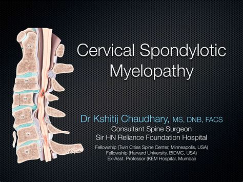 Cervical Spondylotic Myelopathy Pdf