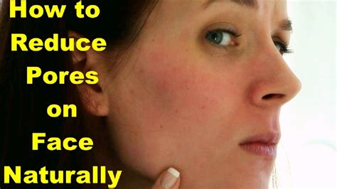 How To Reduce Pores On Face Naturally Remove Large Pores In Day YouTube
