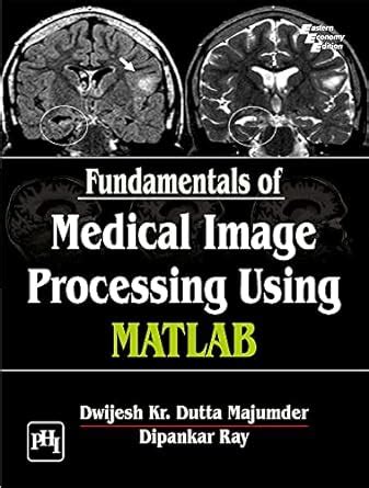 Fundamentals Of Medical Image Processing Using MATLAB Majumder