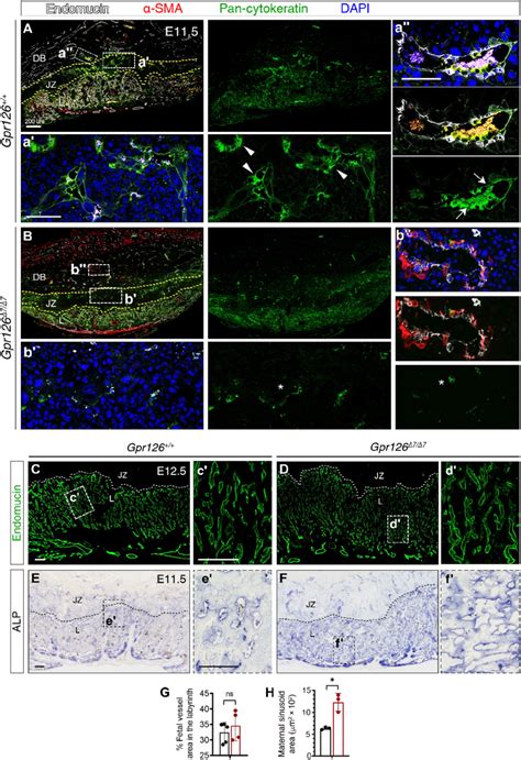 Gpr126 7 7 Mutant Placentas Show Defective Maternal Spiral Arteries