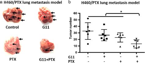The Effects Of G11 In A Paclitaxel Resistant Lung Cancer Metastasis