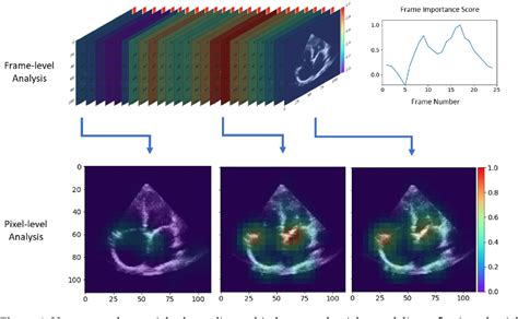 Figure 4 From Automated Atrial Fibrillation Diagnosis By Echocardiography Without Ecg Accuracy