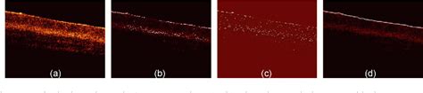 Figure 1 from Near real time classiﬁcation of optical coherence