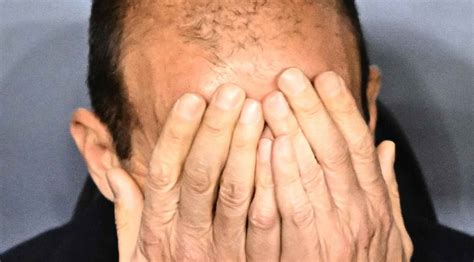 Allegri Dramma Offensivo E Altri Problemi La Situazione è Terribile