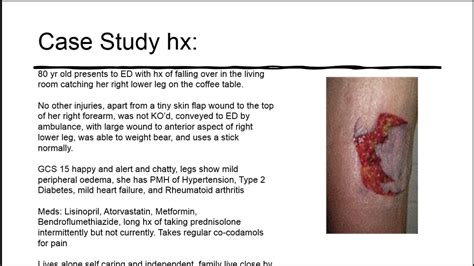 Mild Skin Avulsion