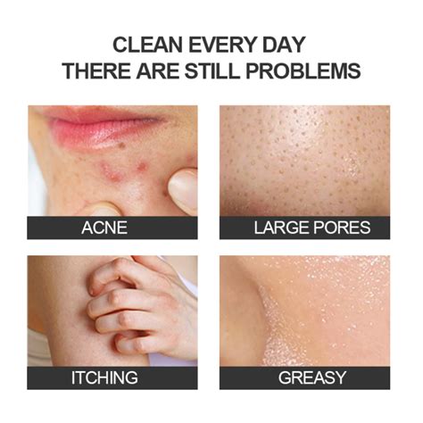 Buy Wholesale China Dropship Kojic Acid Whitening Soap Face Body Care