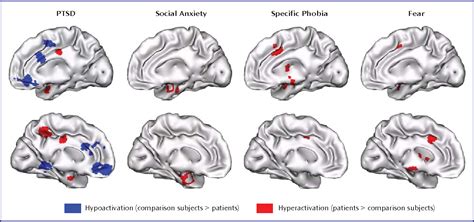 Figure 2 From Functional Neuroimaging Of Anxiety A Meta Analysis Of