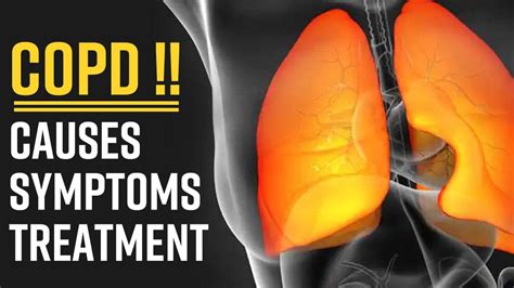 Copd Causes Symptoms And Treatment Of Chronic Obstructive Pulmonary