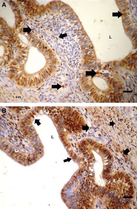 Immunohistochemical Localization Of Erα In Isthmus Of The Bovine