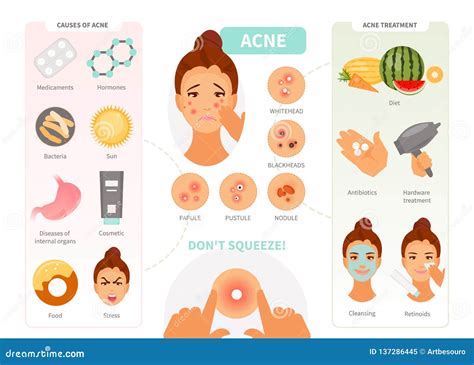 Acne Infographic Vector Stock Vector Illustration Of Diet 137286445