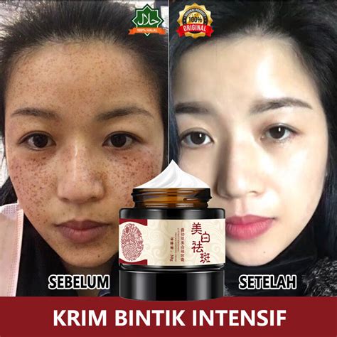 Whitening Freckle Remover Cream Krim Jeragat Pigmentation Dark Spot Black Spot Remove 祛斑霜 g