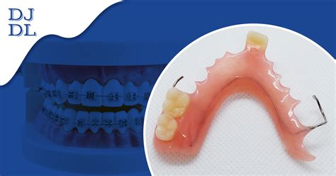 Dental Flipper Everything You Need To Know Blog Flipper