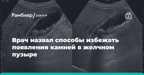 Врач назвал способы избежать появления камней в желчном пузыре ...