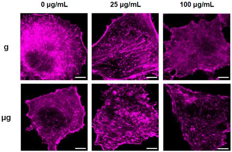 Observation Of F Actin Distribution By Rhodamine Phalloidin Staining