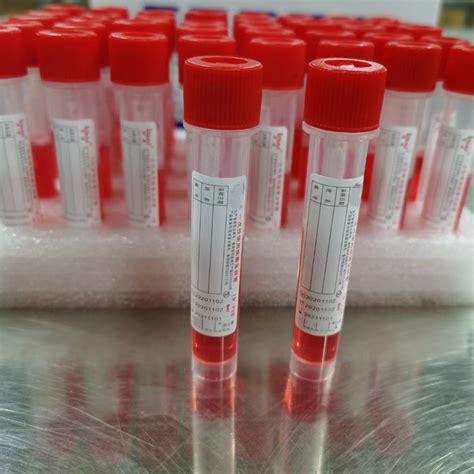Ce Sterilized Disposable Virus Specimen Collection Sampling Tube With