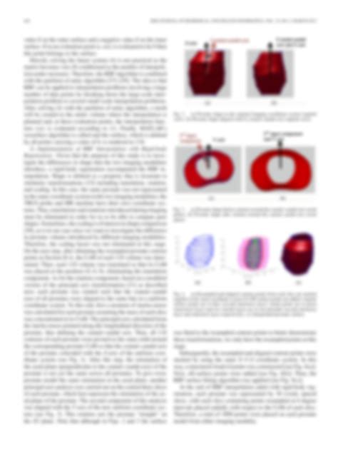Solution A Comparison Of Us Versus Mr Based 3 D Prostate Shapes Using