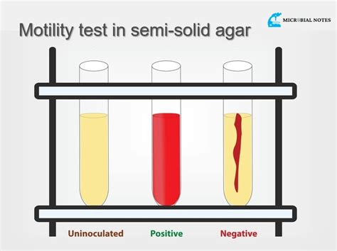 Determine Bacterial Motility With Semi Solid Agar Method