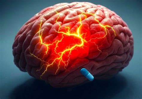 Seizure Prophylaxis In Ich Ncs Guidelines Summary