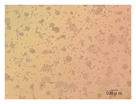 CPE Of LMH Cells Infected With The N DRV LY A H Infected Download Scientific Diagram