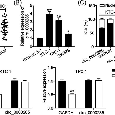 Hsa Circ 0000285 Level Was Remarkably Elevated In Thca A‐b The