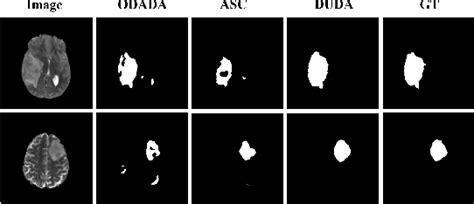 Figure 3 From Unsupervised Domain Adaptation For Medical Image