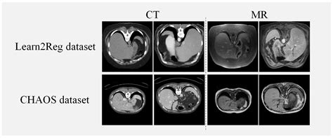 Dtr Gan An Unsupervised Bidirectional Translation Generative Adversarial Network For Mri Ct