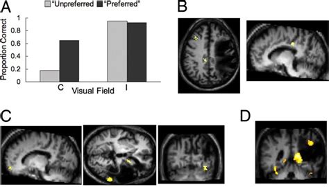 functional neuroimaging data a proportion of correct responses as a