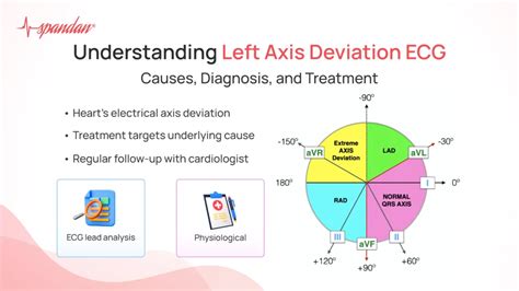 Left Axis Deviation Ecg Causes Diagnosis And Treatment